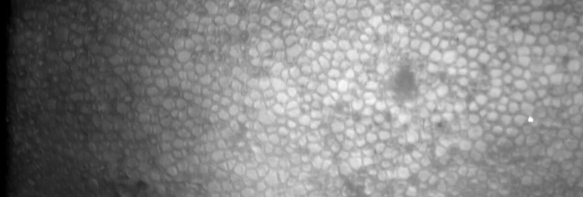 Corneal Learning for Endothelial Assessment and Review using AI for ...